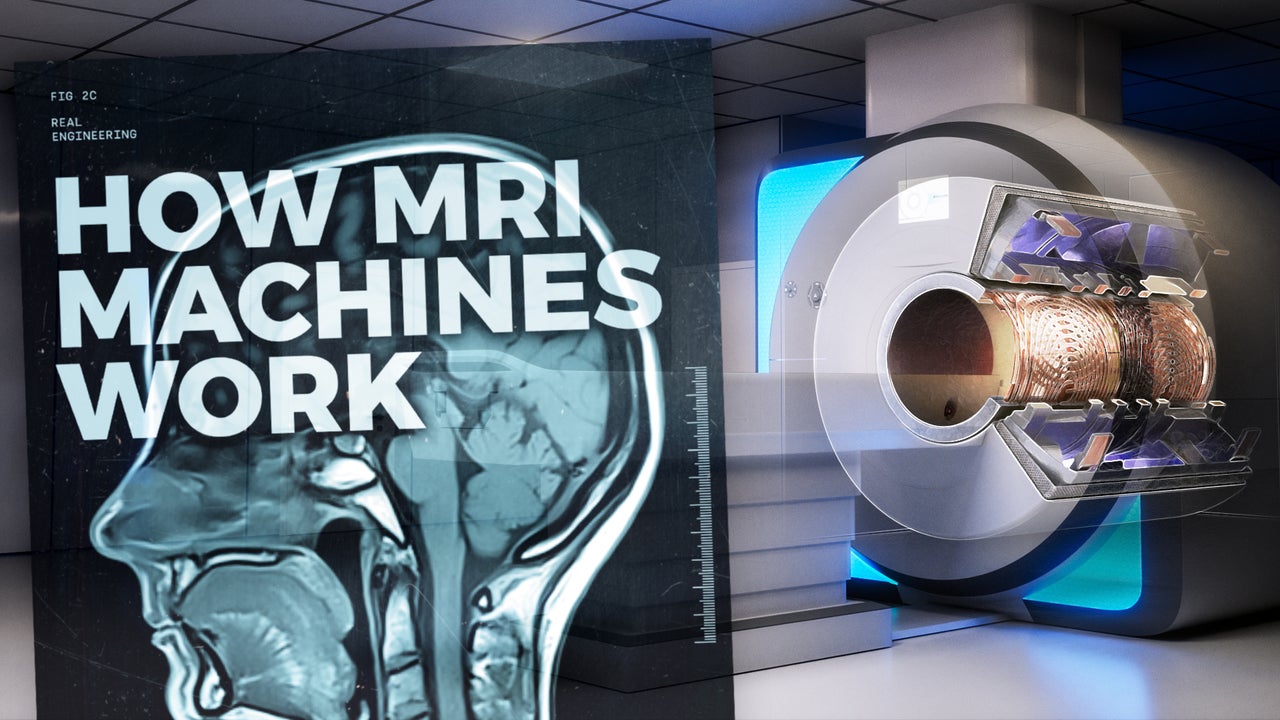 The Insane Engineering of MRI Machines | Nebula